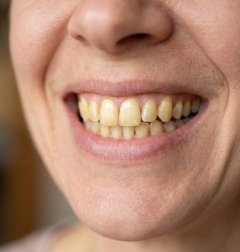 My Nana’s 2-Minute Teeth Whitening Trick Actually Worked… But There’s a ...