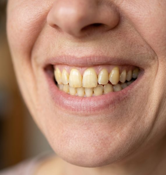 My Nana’s 2-Minute Teeth Whitening Trick Actually Worked… But There’s a ...